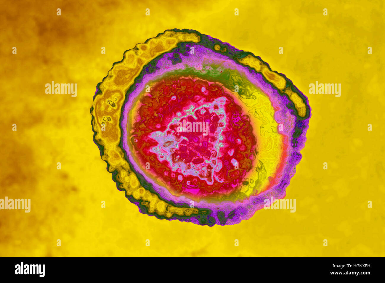 Virus Del Herpes Fotografías E Imágenes De Alta Resolución Alamy