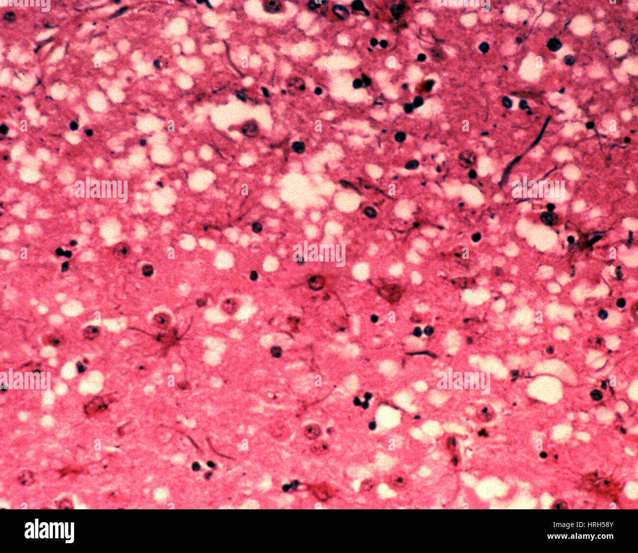 Tejidos Del Cerebro De Vaca Fotografías E Imágenes De Alta Resolución