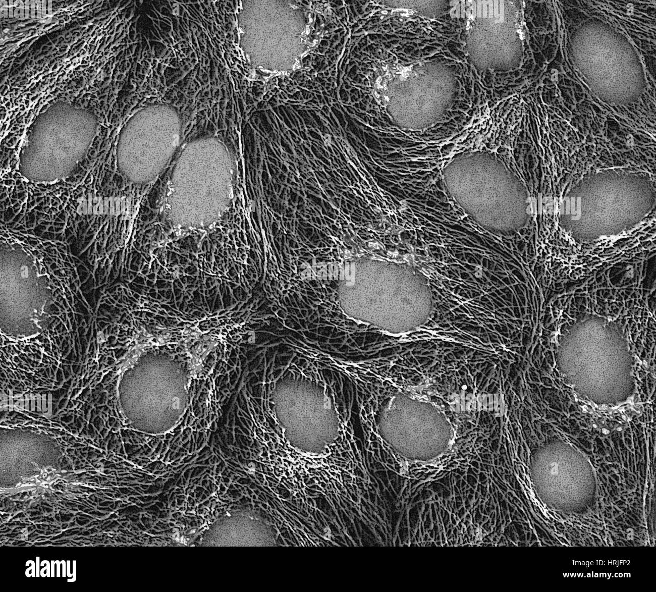 C lulas HeLa MFM Fotograf a De Stock Alamy c-lulas-hela-mfm-fotograf-a-de-stock-alamy