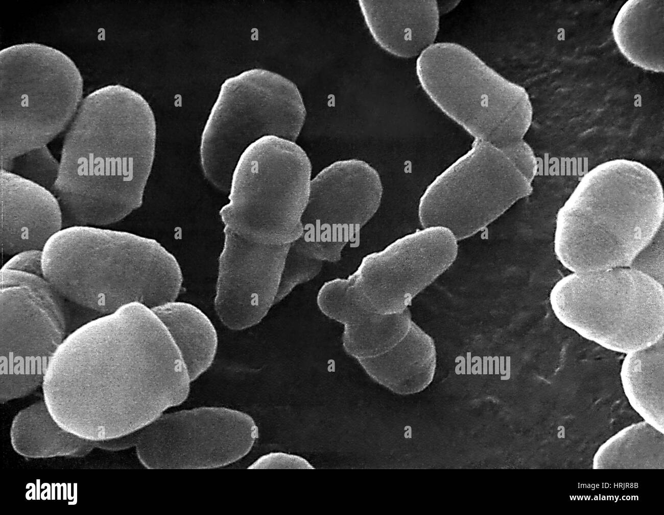 Malassezia Lipophilis Hongos SEM Fotograf a De Stock Alamy malassezia-lipophilis-hongos-sem-fotograf-a-de-stock-alamy