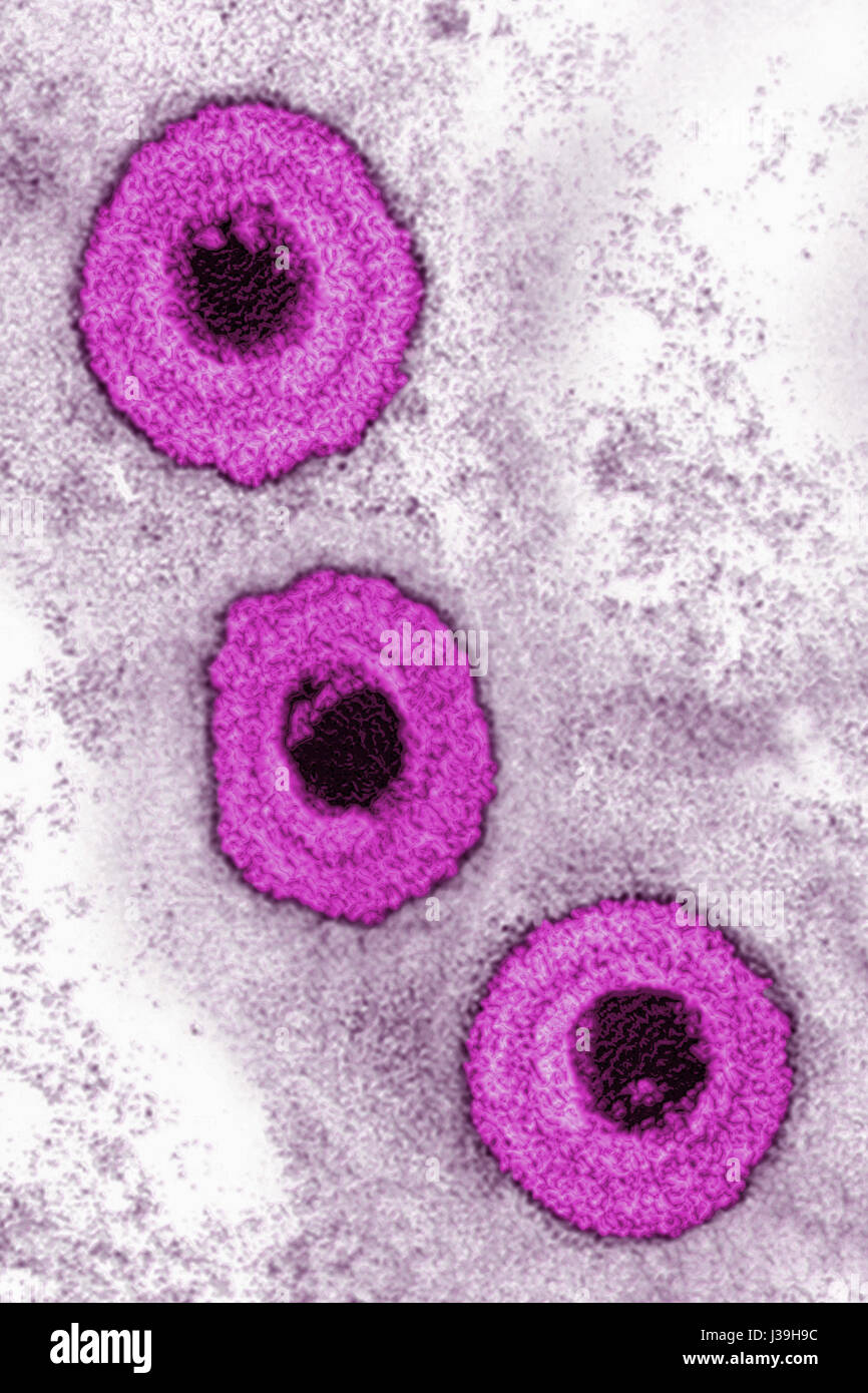 Herpes Genital Fotografías E Imágenes De Alta Resolución Alamy