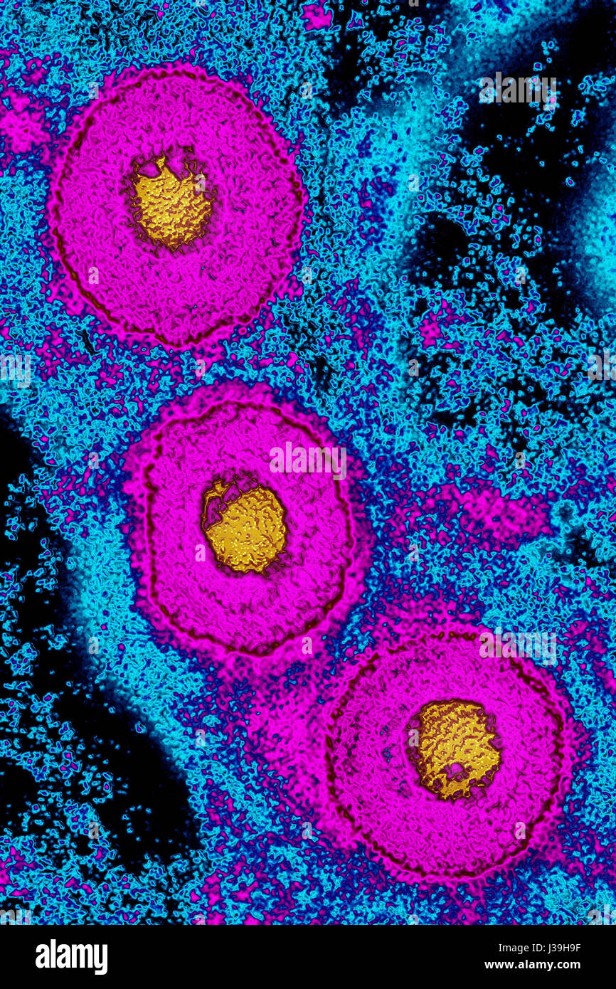 Herpes Genital Fotografías E Imágenes De Alta Resolución Alamy