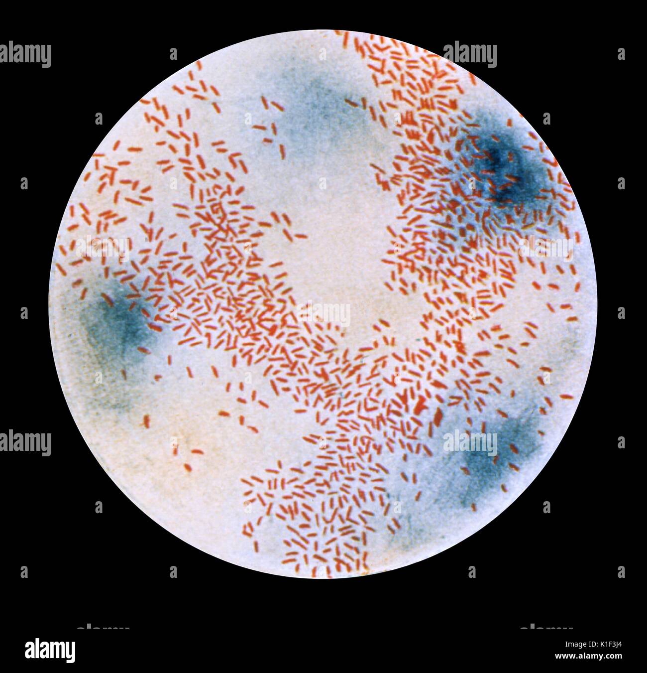 Streptococcus Salivarius Tinción De Gram