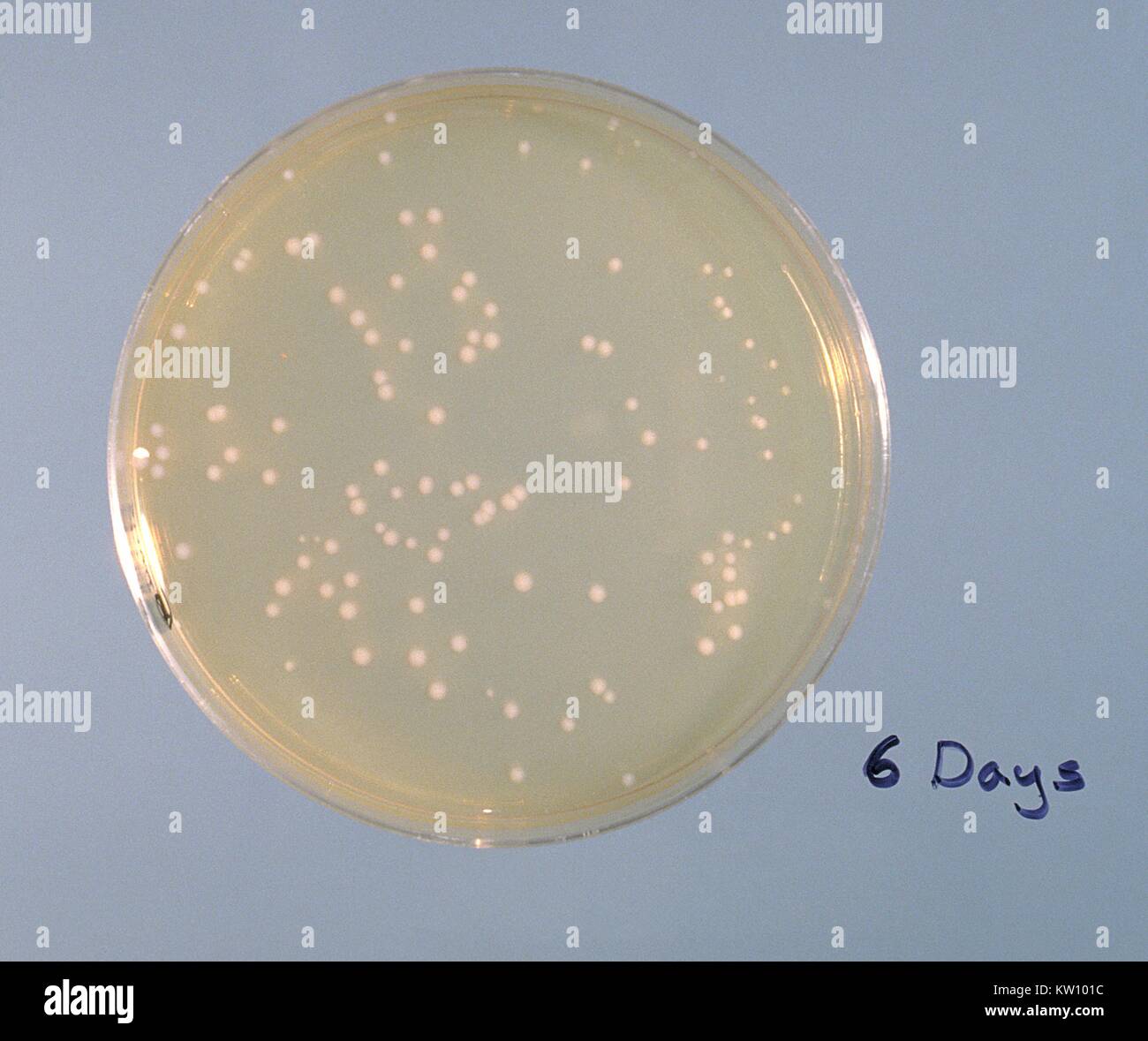 Legionella Agar