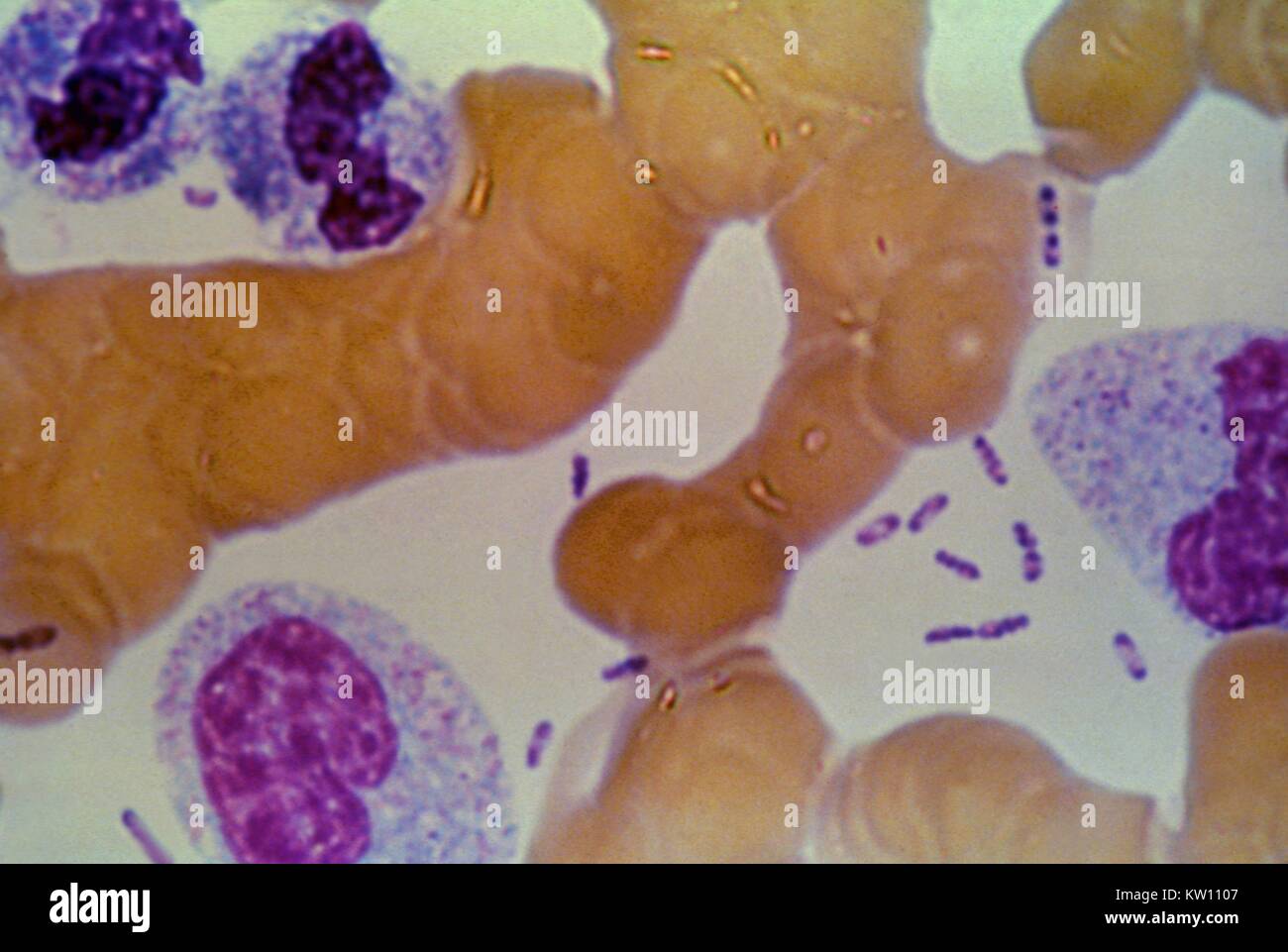 Safety Pin Appearance Yersinia Pestis at Virginia Nealon blog