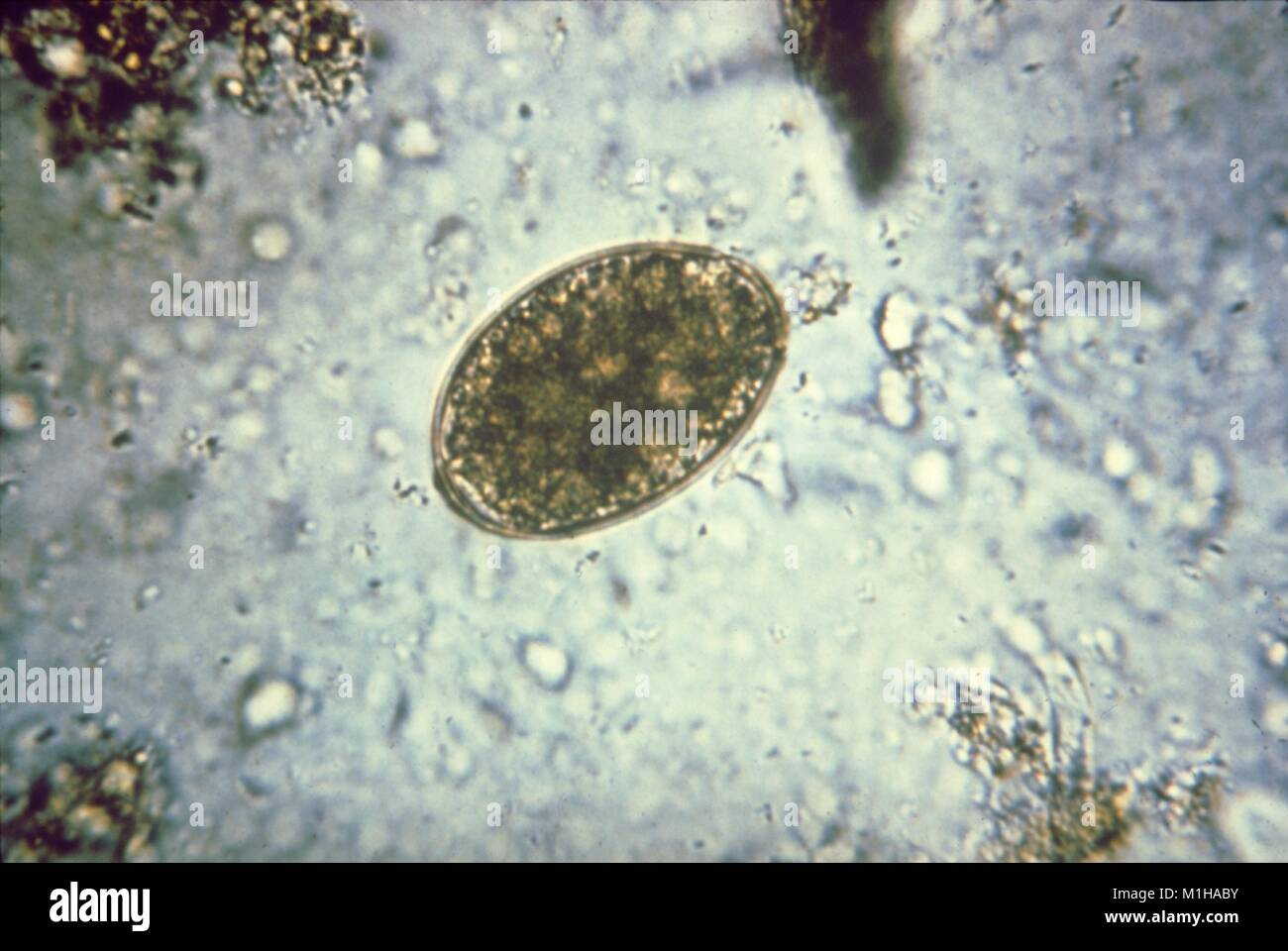 Fotos De Tenias En Humanos