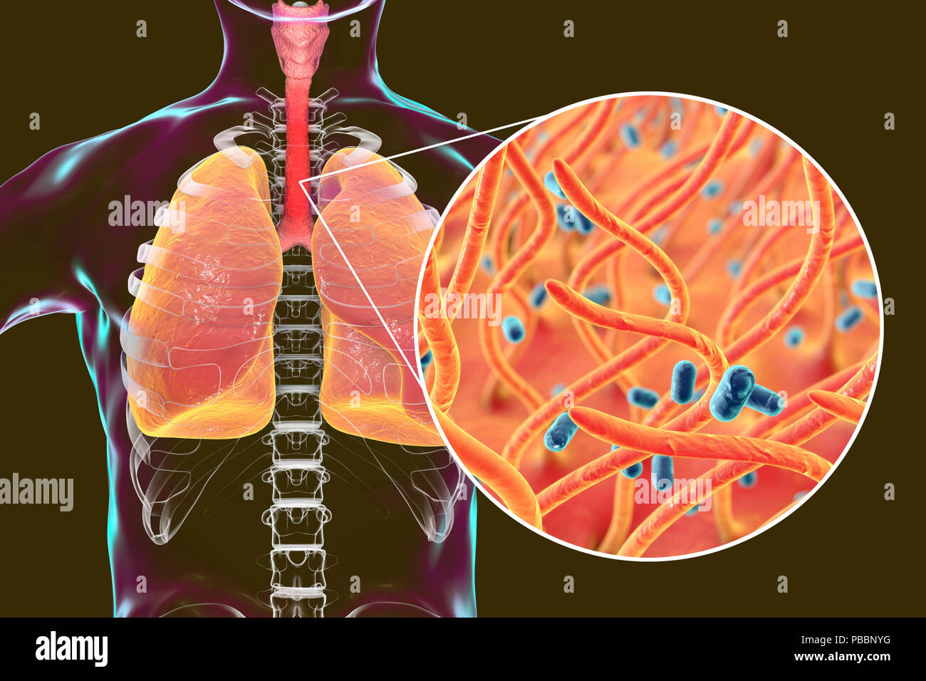 Enfermedad De La Tos Ferina