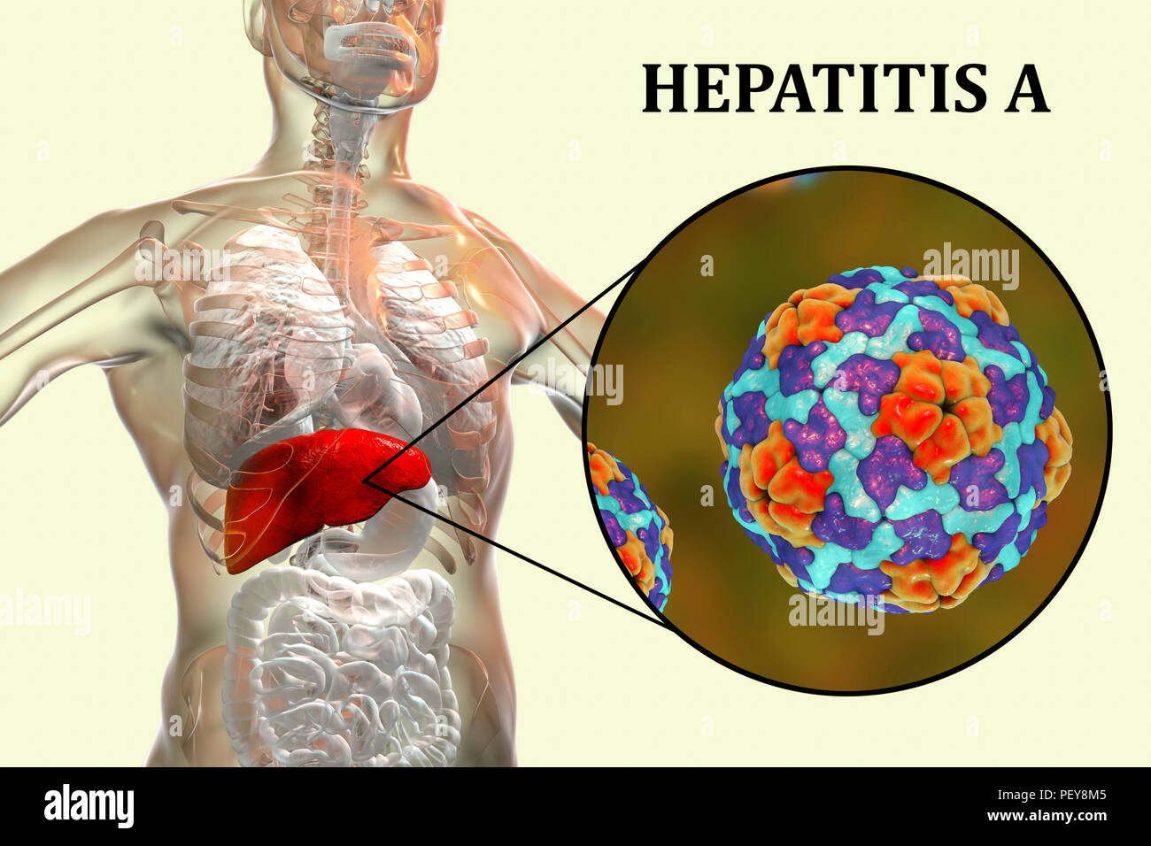 Fotos Del Virus De La Hepatitis A