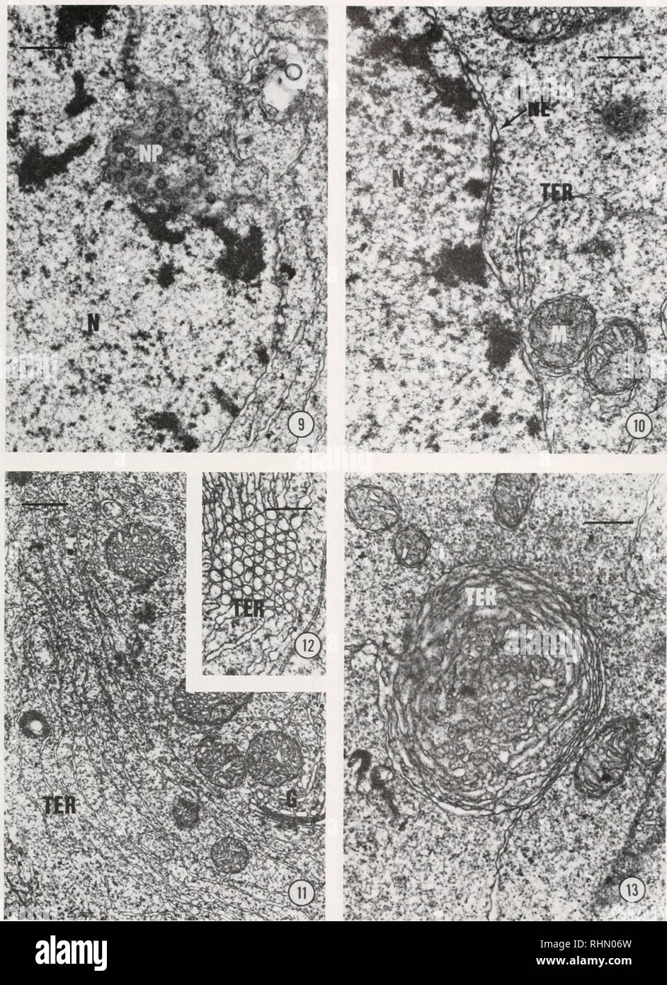 Complejo De Poros Nucleares Em