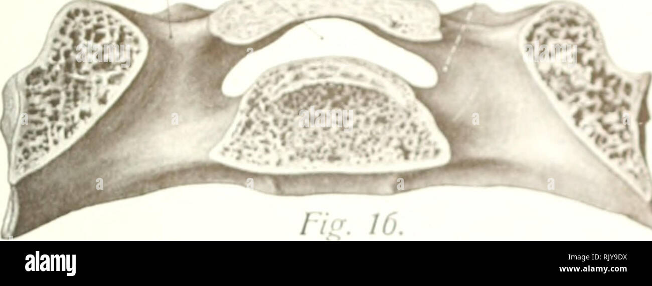 Cresta Sacra Mediana