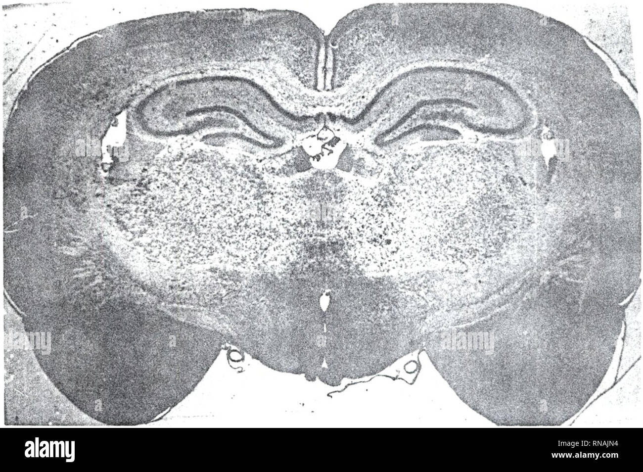 Diagrama De Disección De Cerebro De Rata