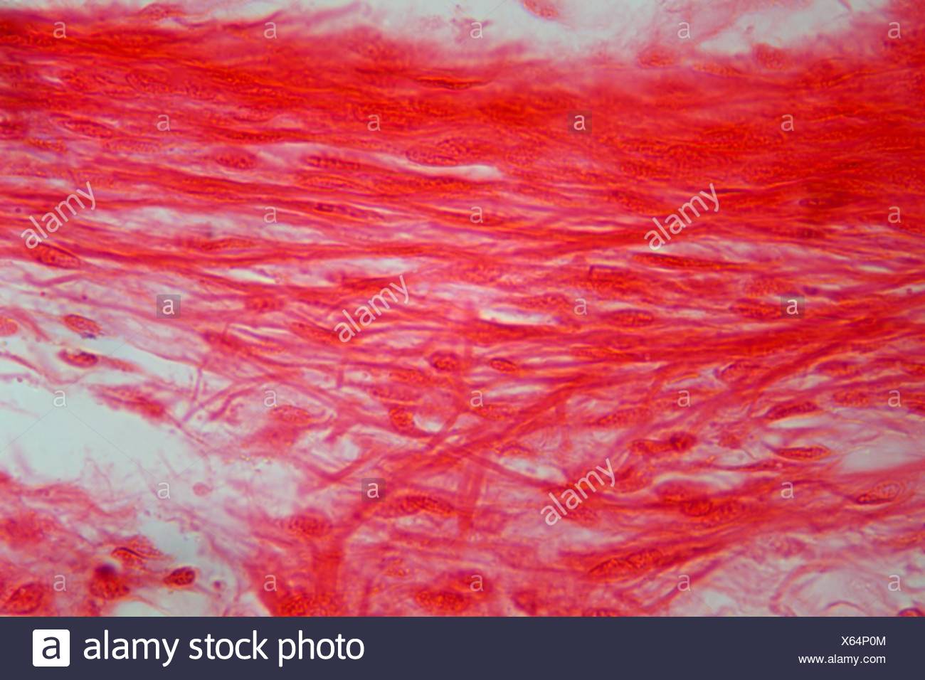 Traqueideos Sob Microscopio