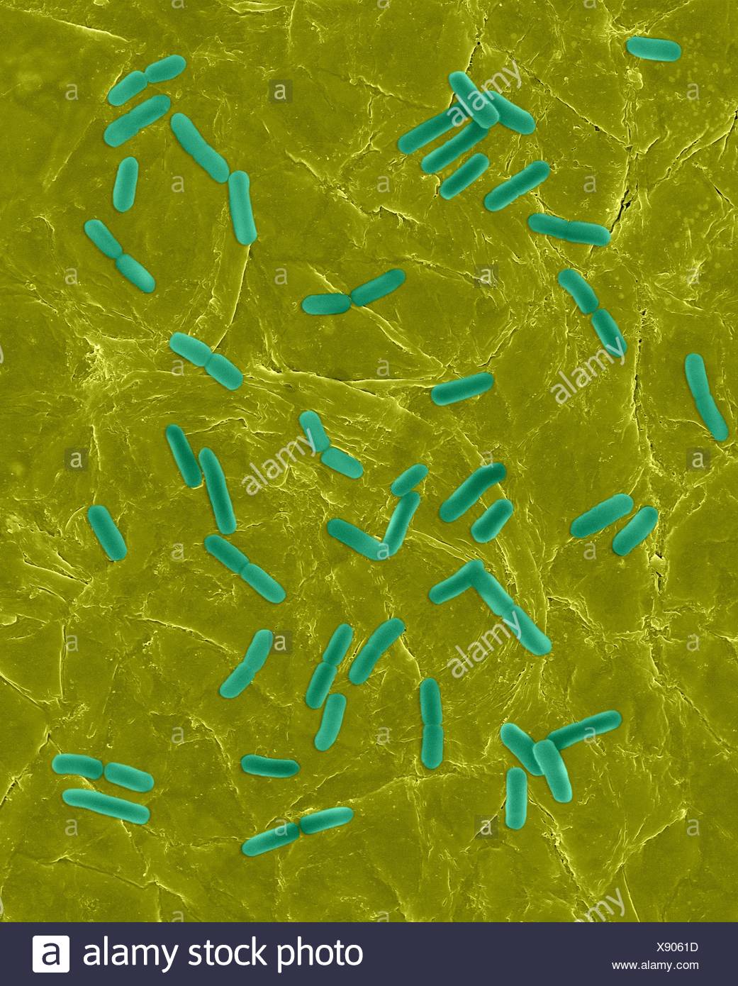 Bacteriasmicroscopicasdelaescarlatina
