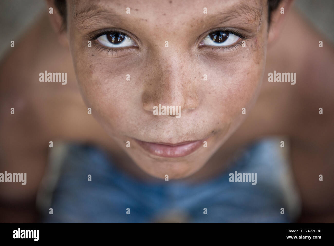 Taches de rousseur face Banque de photographies et d’images à haute ...