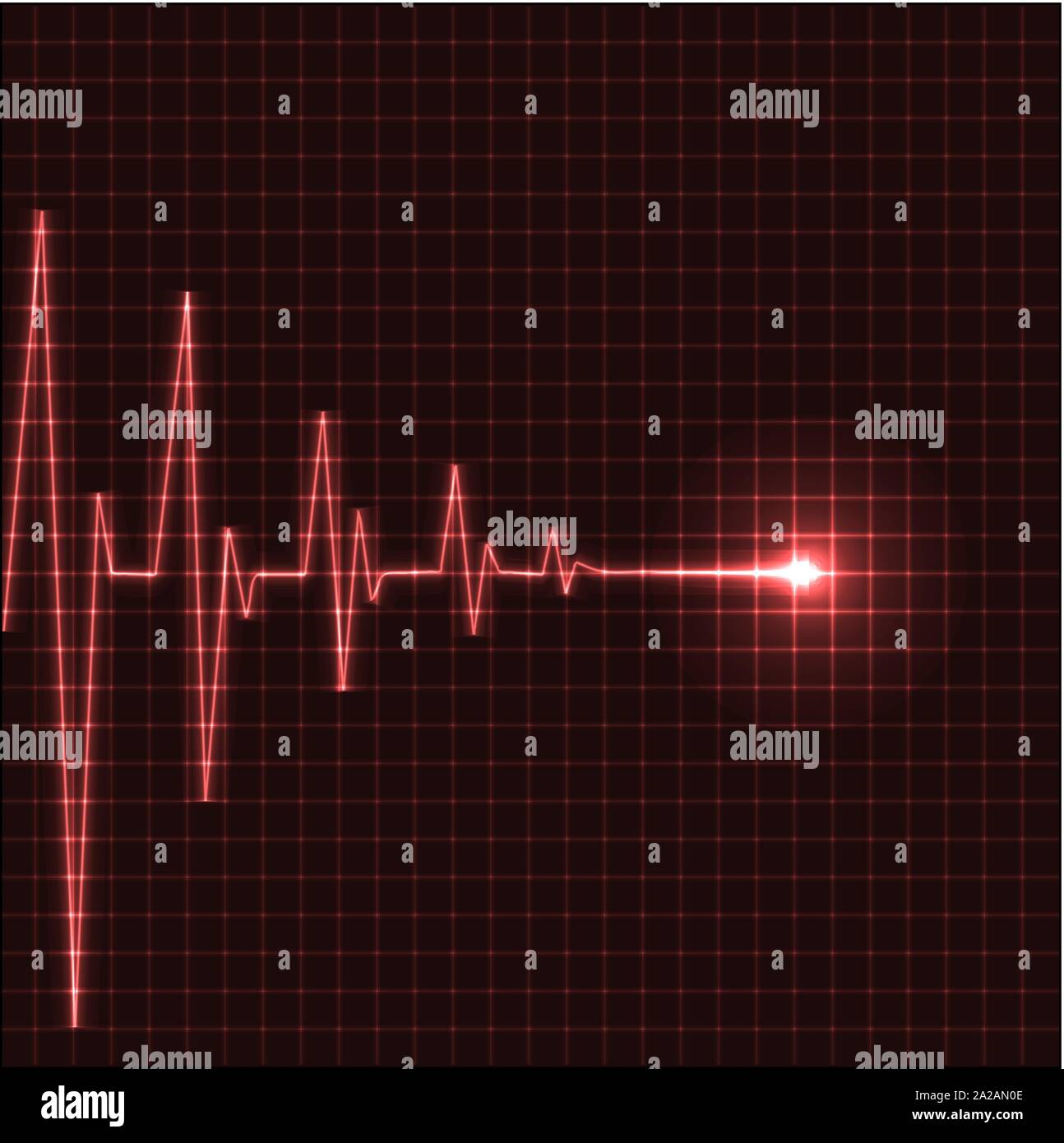 électrocardiogramme normal Banque d'images vectorielles - Alamy