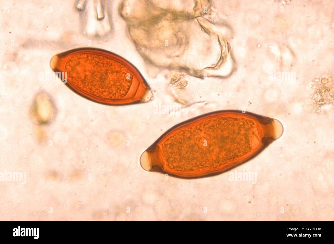 Trichuris trichiura Banque de photographies et d’images à haute ...