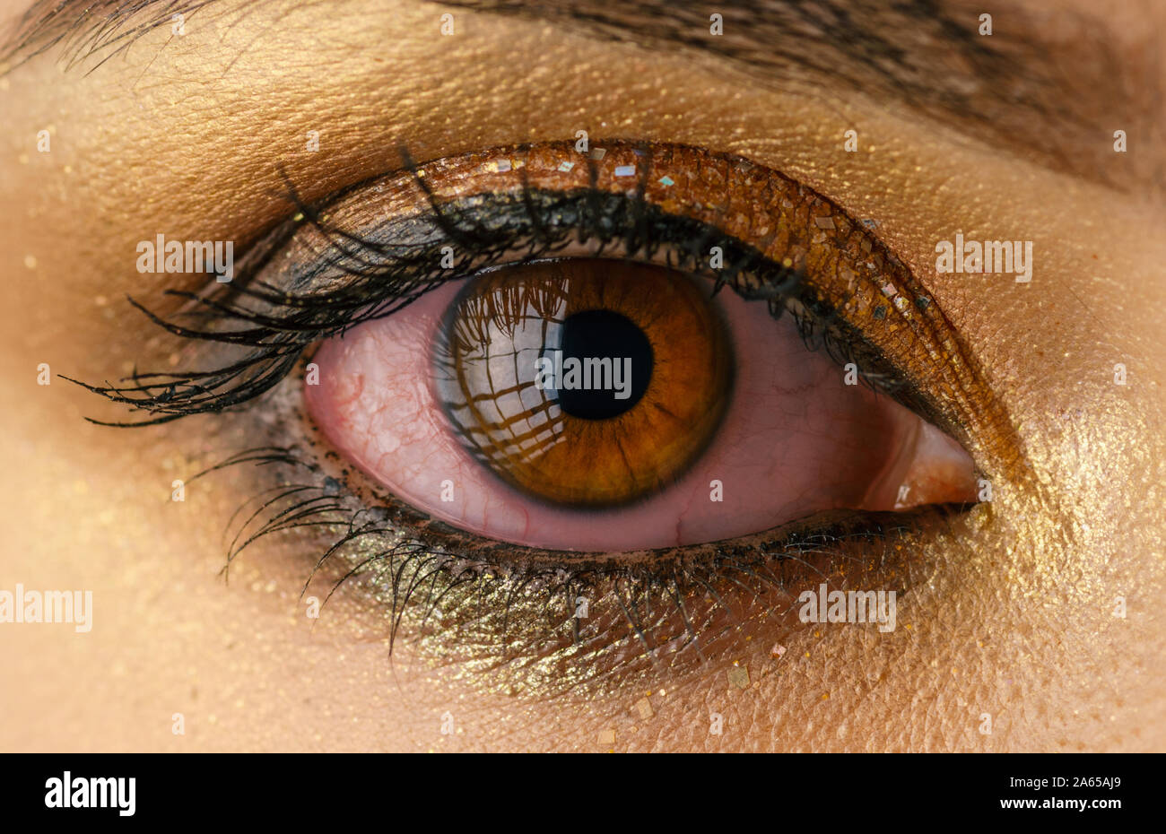 Conjunctivitis veins Banque de photographies et d’images à haute ...