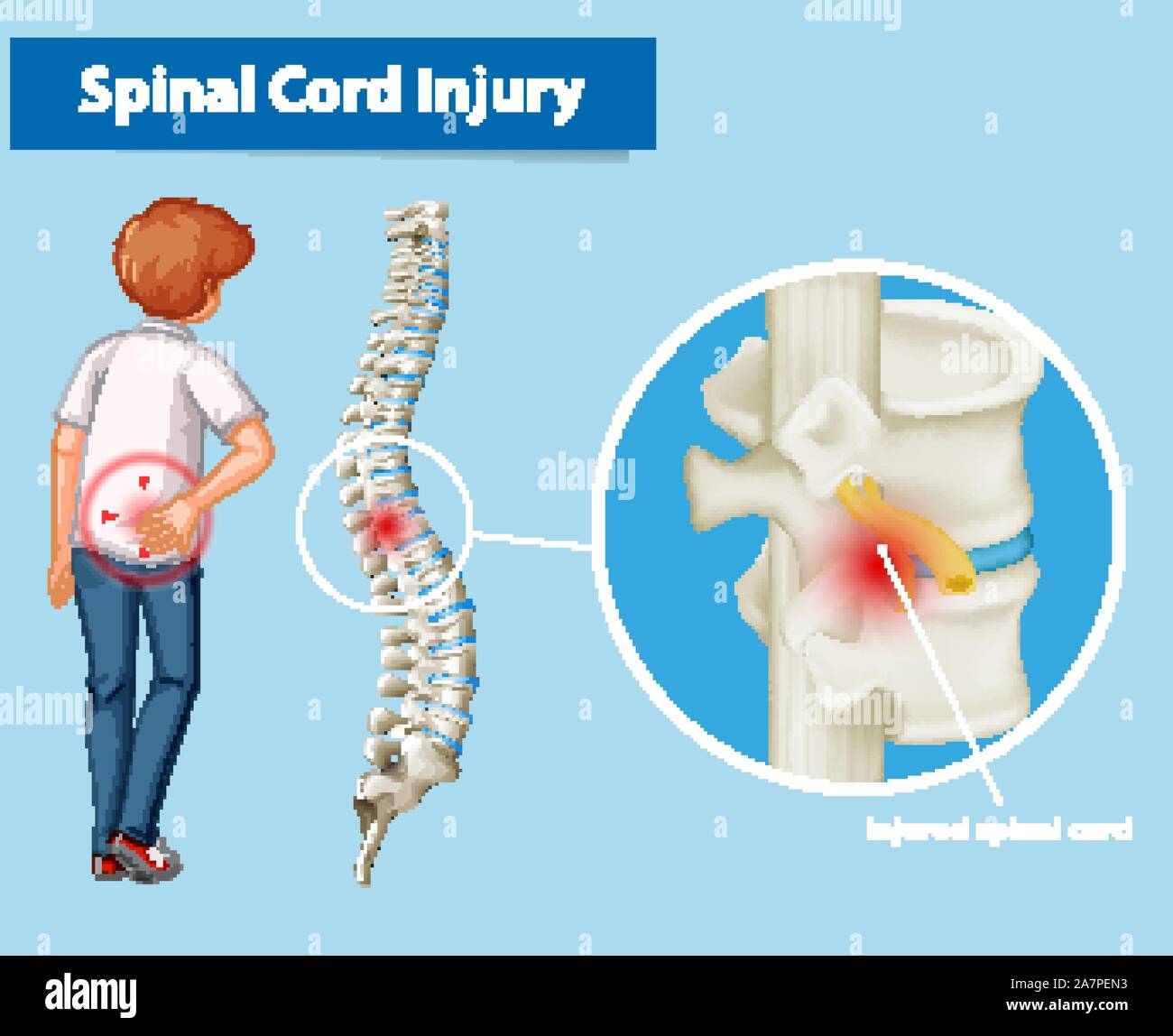 Schéma de l'illustration de la moelle épinière Image Vectorielle Stock ...