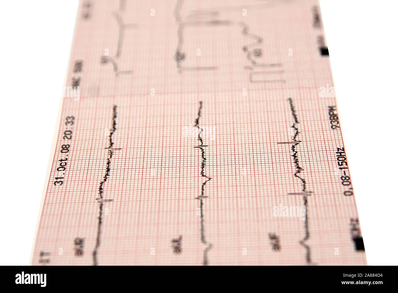 Ecg machine electrocardiogram machine Banque de photographies et d ...