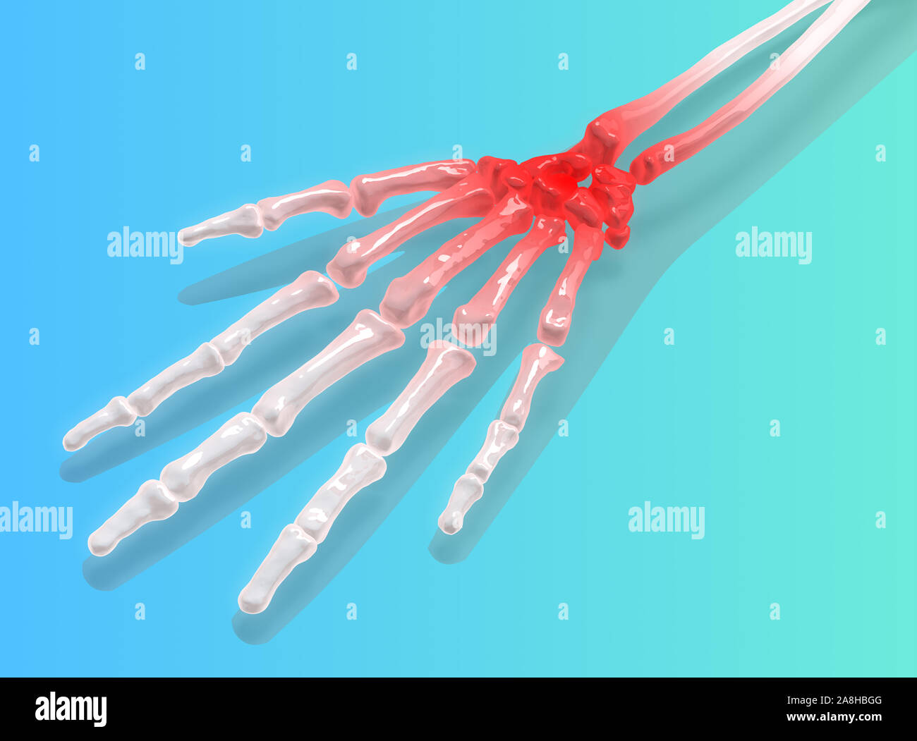 Santé des os squelette rouge domaine médical douleur du canal carpien ...