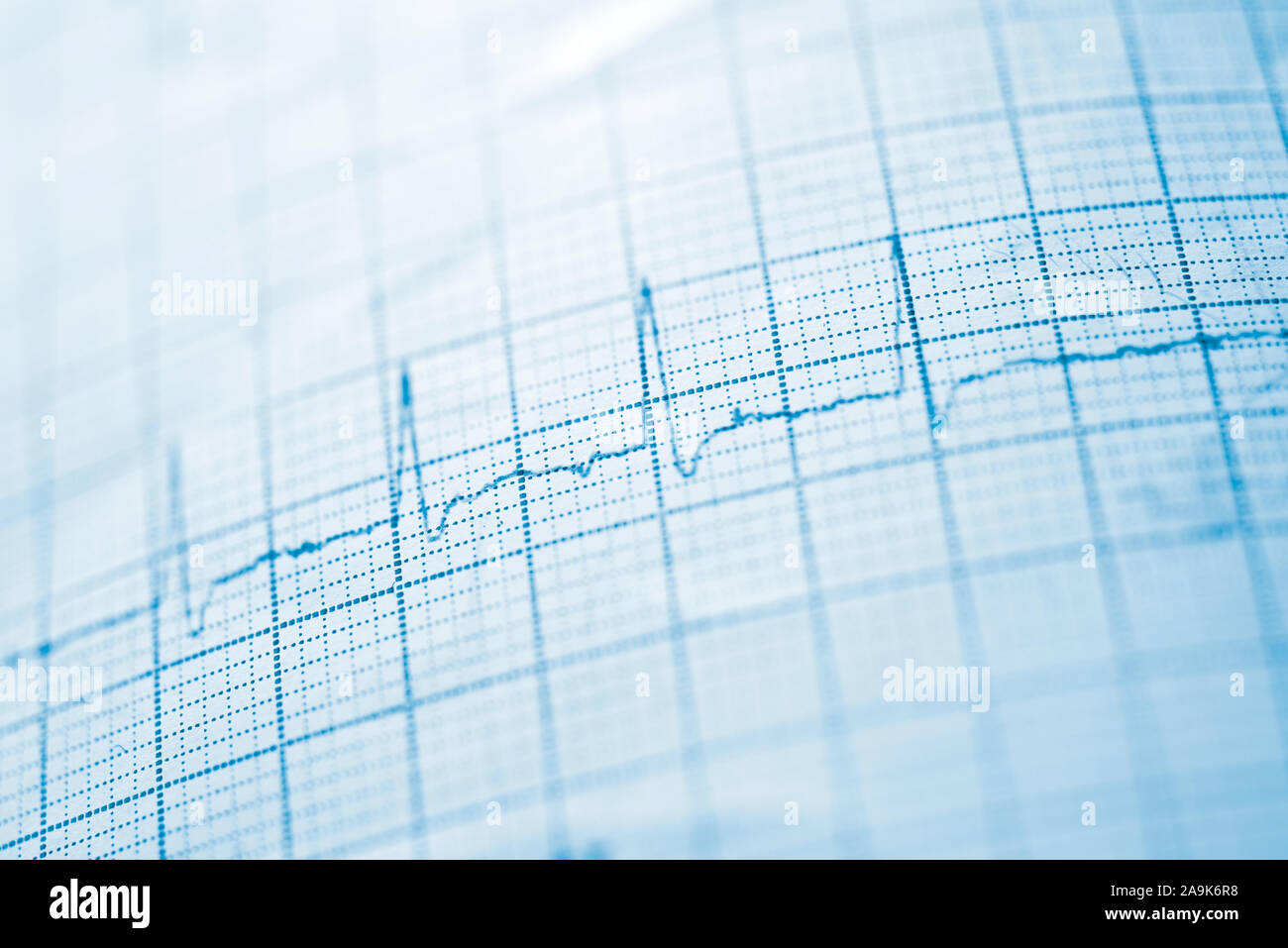 Electrocardiogram Ecg Banque d'image et photos - Alamy