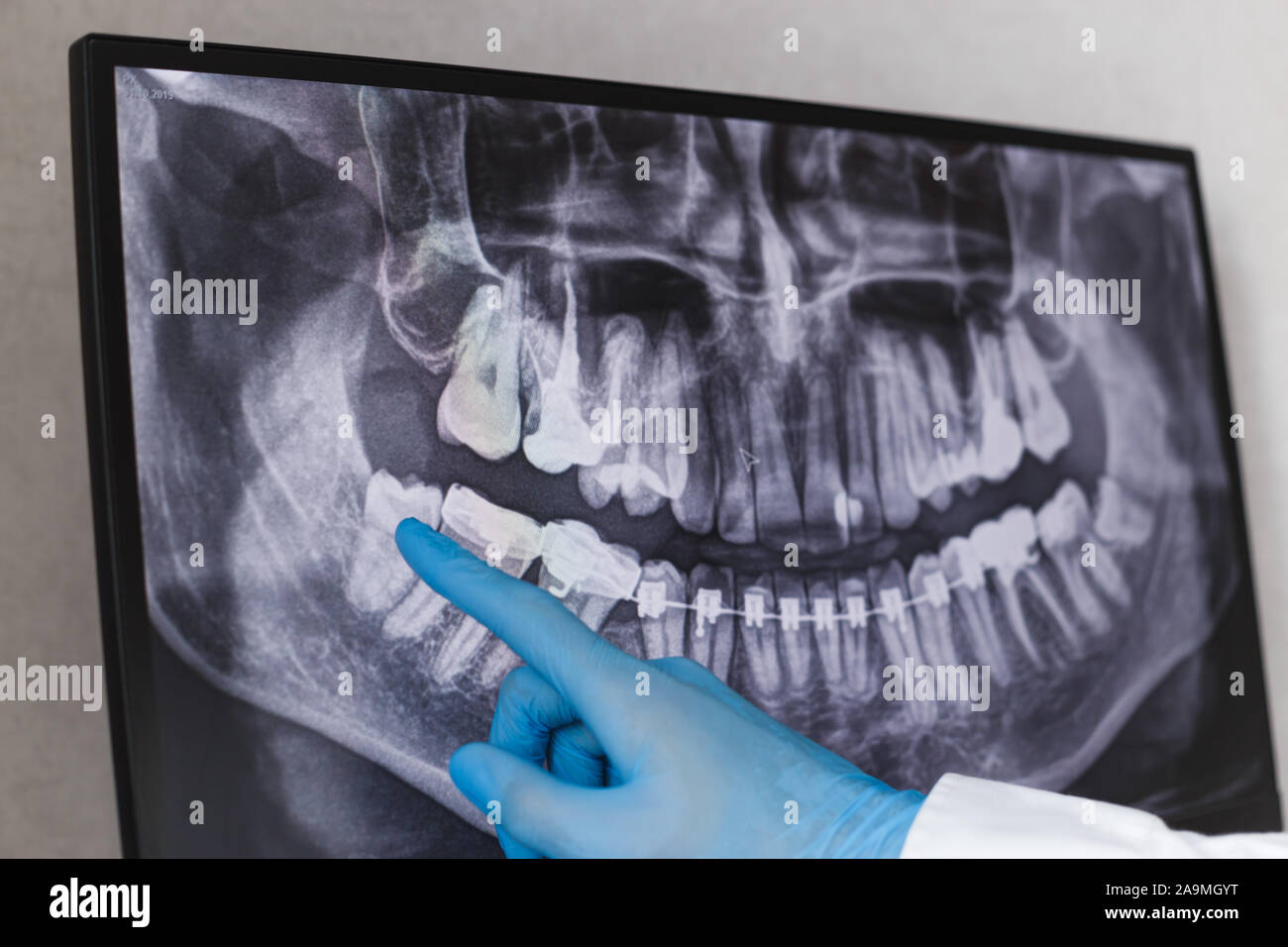 Examen dental de rayos x Banque de photographies et d’images à haute ...