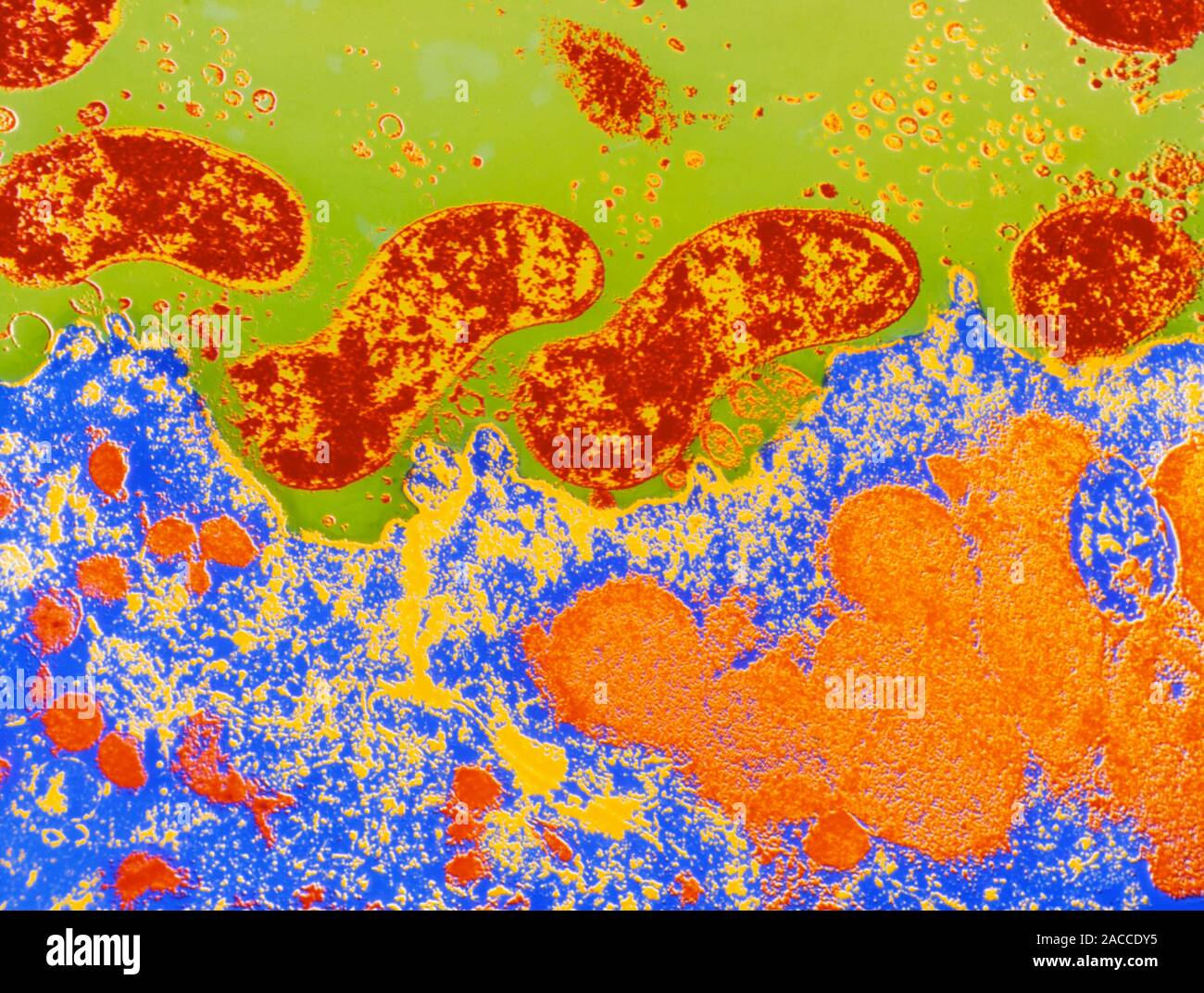 Micrographe de couleur (MET) de la bactérie Helicobacter pylori ...