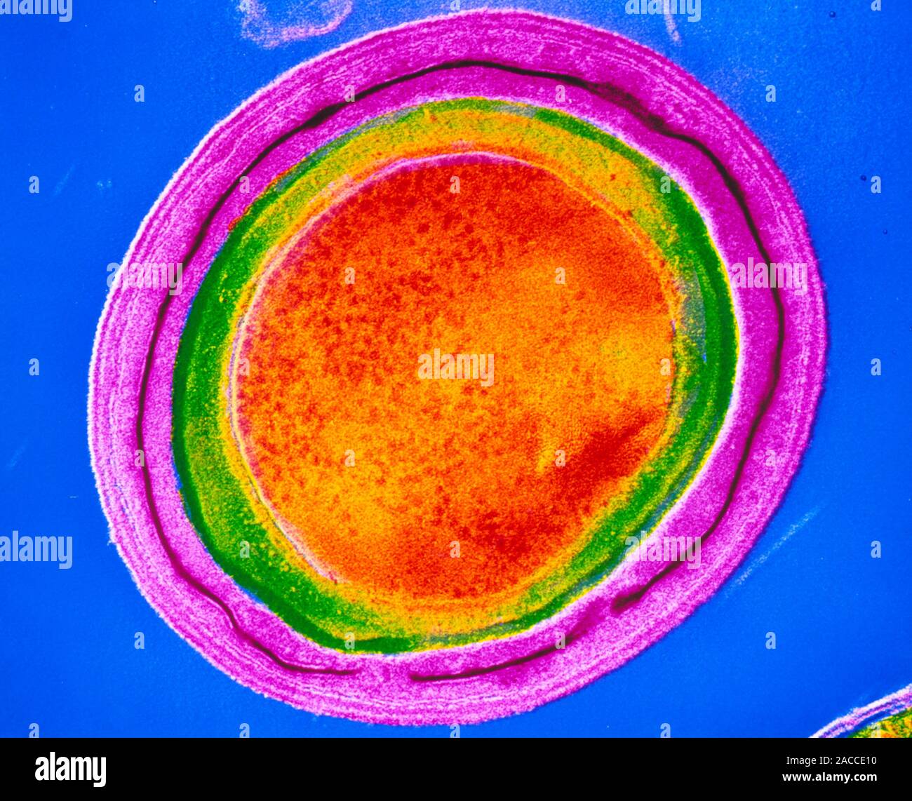 Micrographie électronique à transmission (TEM) d'une spore bactérienne ...