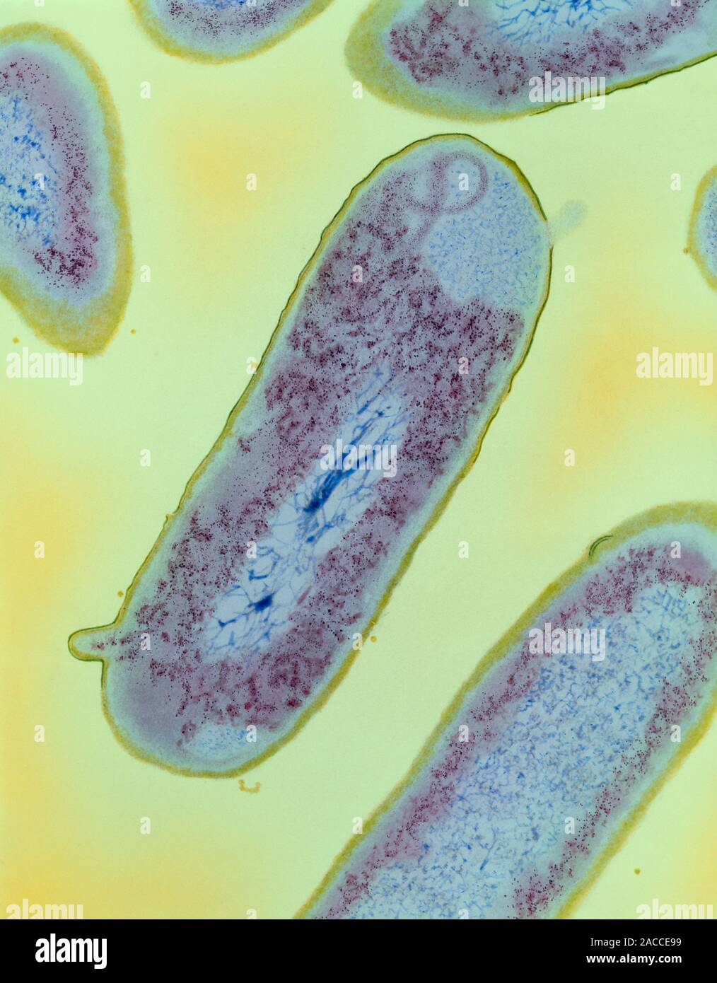 Shigella dysenteriae. Micrographe de couleur (MET) de Shigella ...