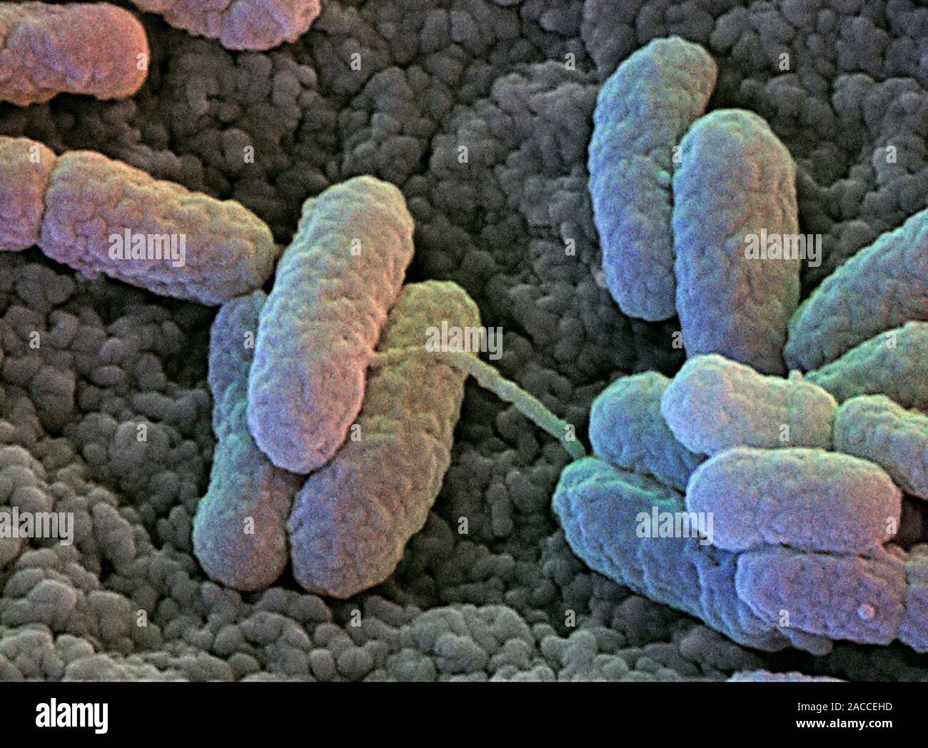 Les bactéries Salmonella enteritidis. Couleur de l'analyse des ...