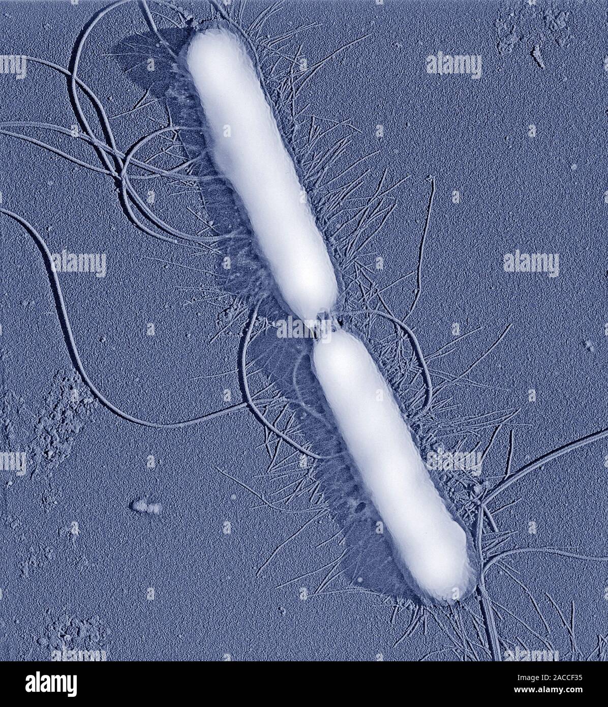 Les bactéries Proteus vulgaris, l'analyse des électrons ...