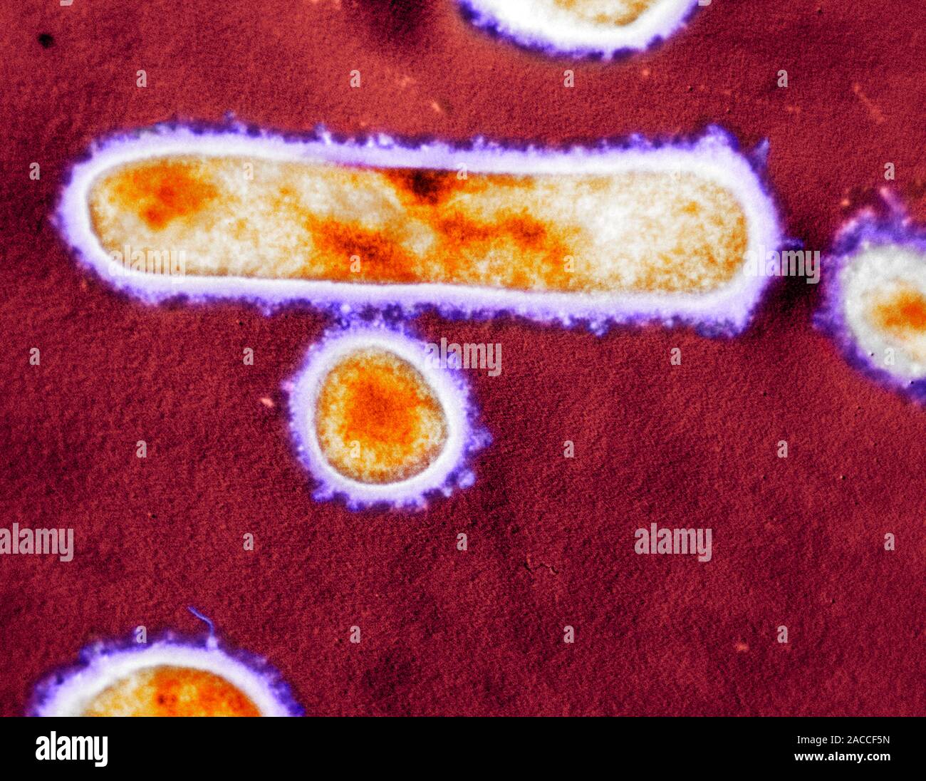 Les bactéries Lactobacillus casei Shirota. Micrographe de couleur (MET ...