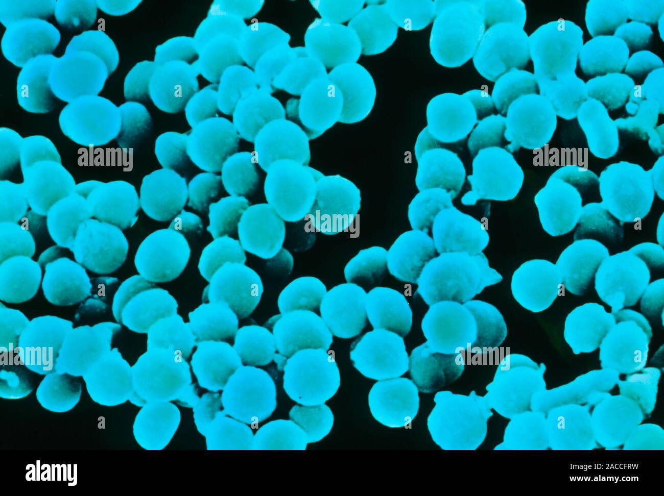Staphylococcus aureus. Couleur de l'analyse des électrons ...