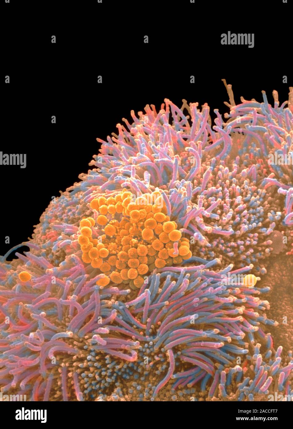 Staphylococcus sp. Couleur de l'analyse des électrons Microphotographie ...