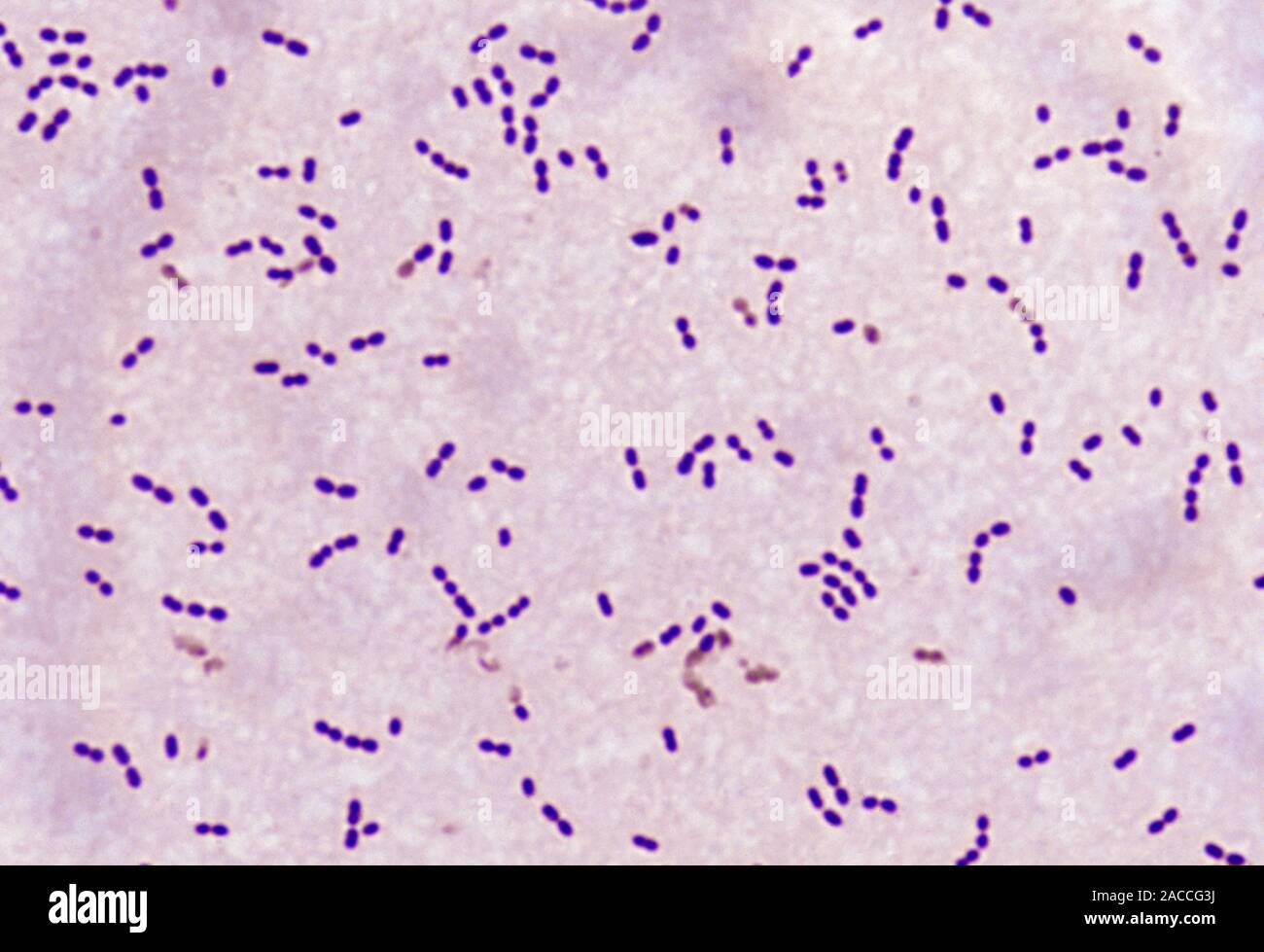 Les bactéries Streptococcus. Micrograph Light de gramme-souillée des ...