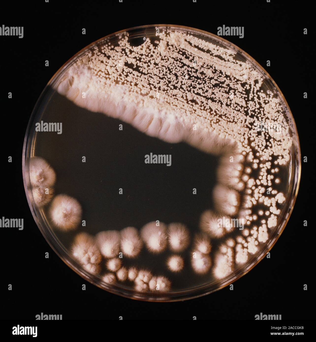 Macrophotographie montrant une boîte de Petri culture de Trichosporon ...