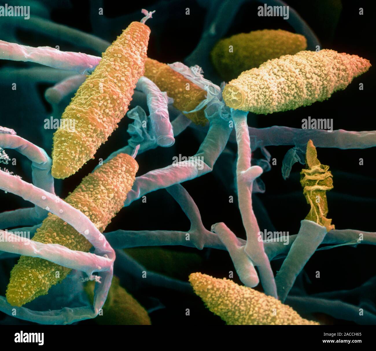 Microsporum champignon. Couleur de l'analyse des électrons ...