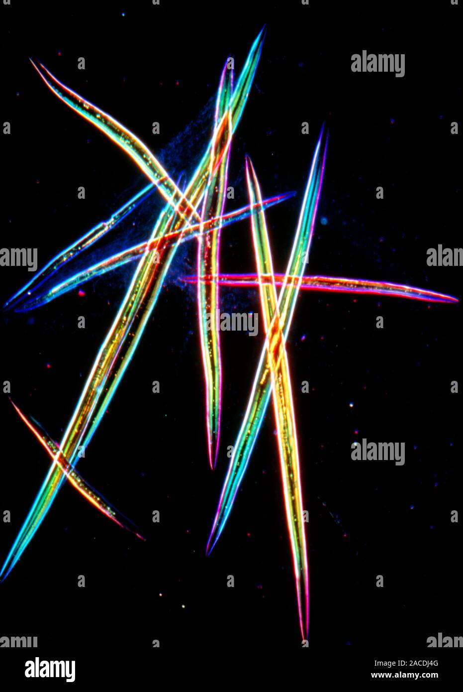 Micrograph Light de sclérides du tissu d'un cactus, Preskia sp. Les ...