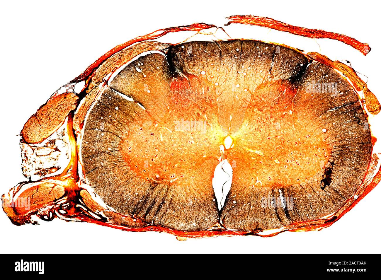 La moelle épinière. Micrograph Light d'une section transversale au ...