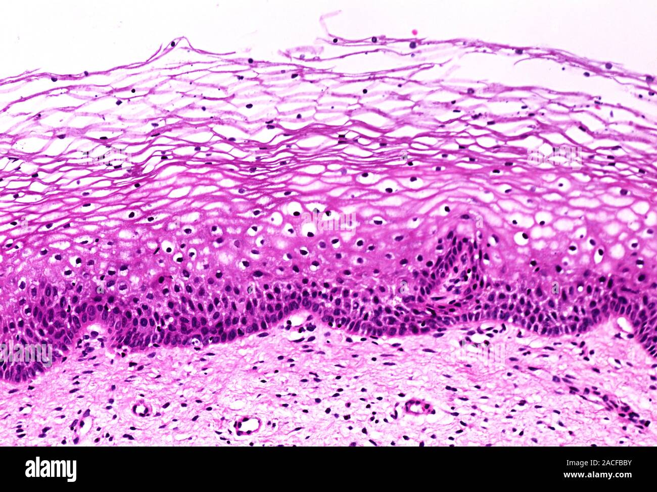 L'épithélium du col de l'utérus. Microphotographie lumière du tissu ...