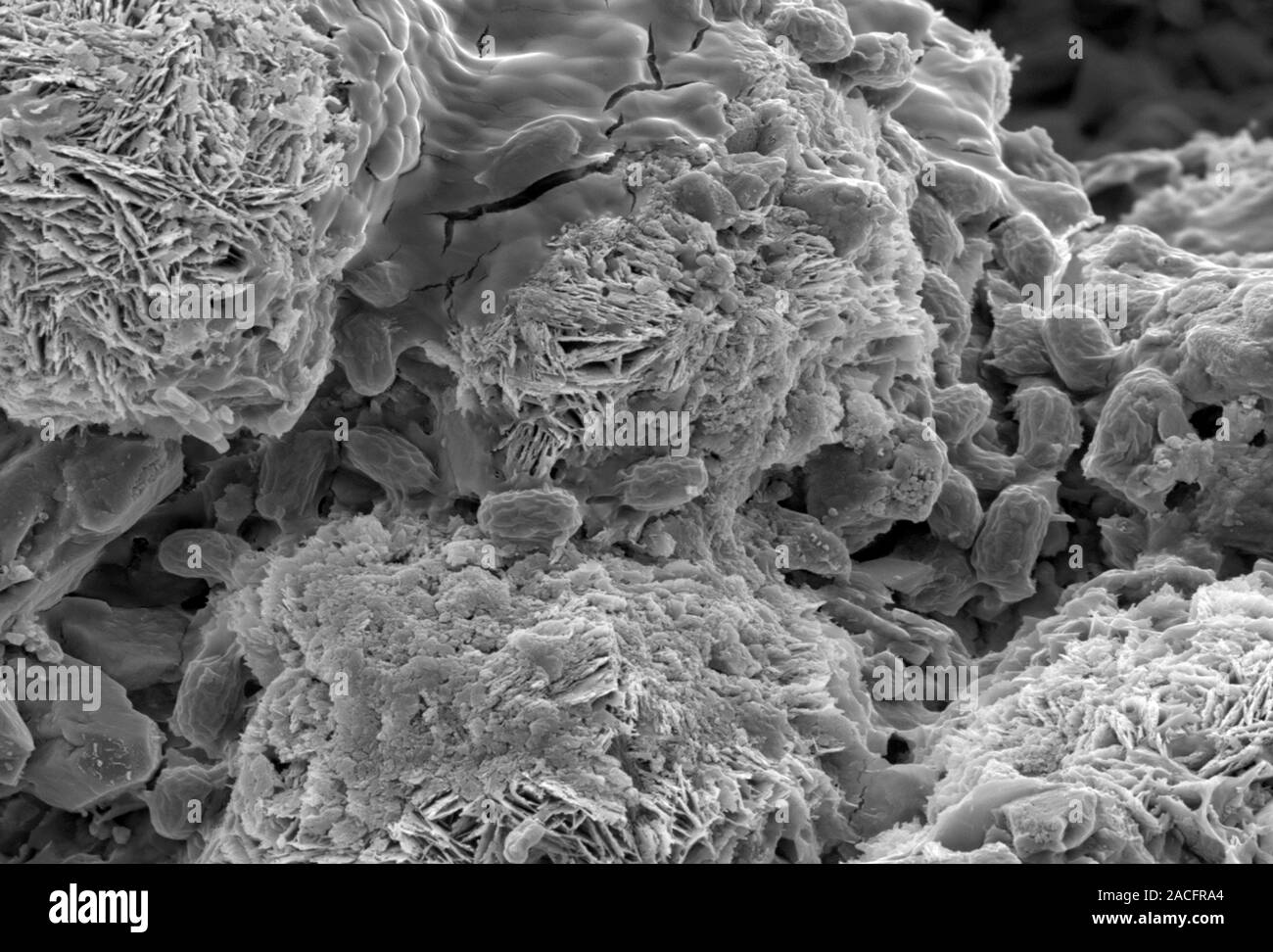 Les bactéries de la biominéralisation, microscope électronique à ...