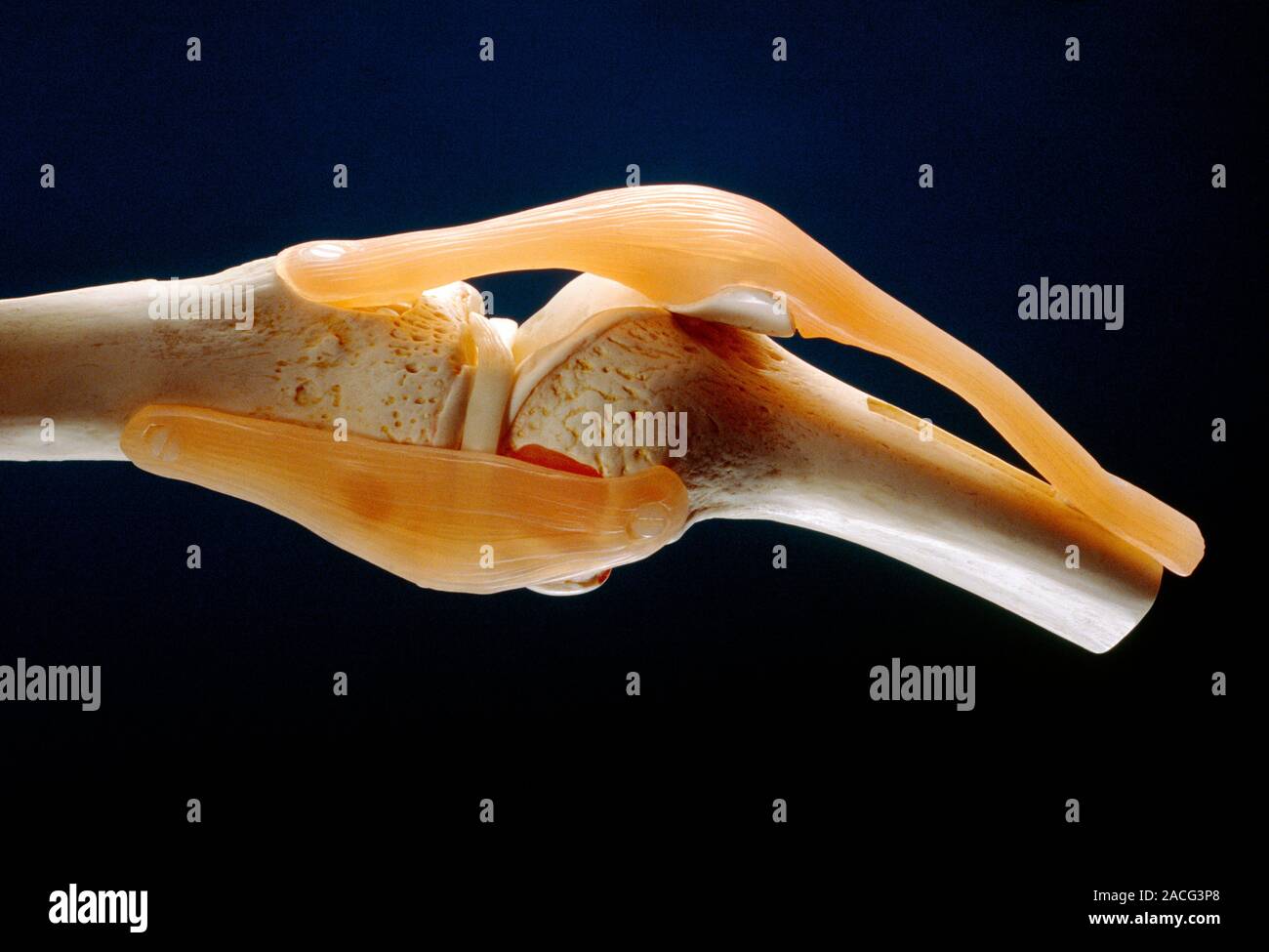 Structure du genou. Modèle d'un genou normal montrant le tibia, à ...