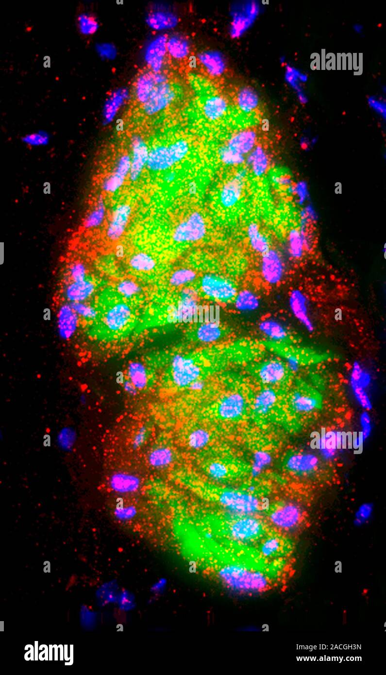 Les faisceaux du nerf cardiaque. La déconvolution de fluorescence d'une ...