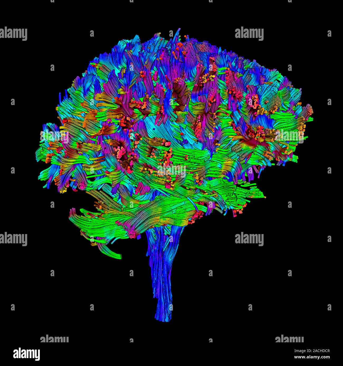 Les fibres de la matière blanche. 3D couleur l'imagerie du tenseur de diffusion (DTI) du cerveau ...