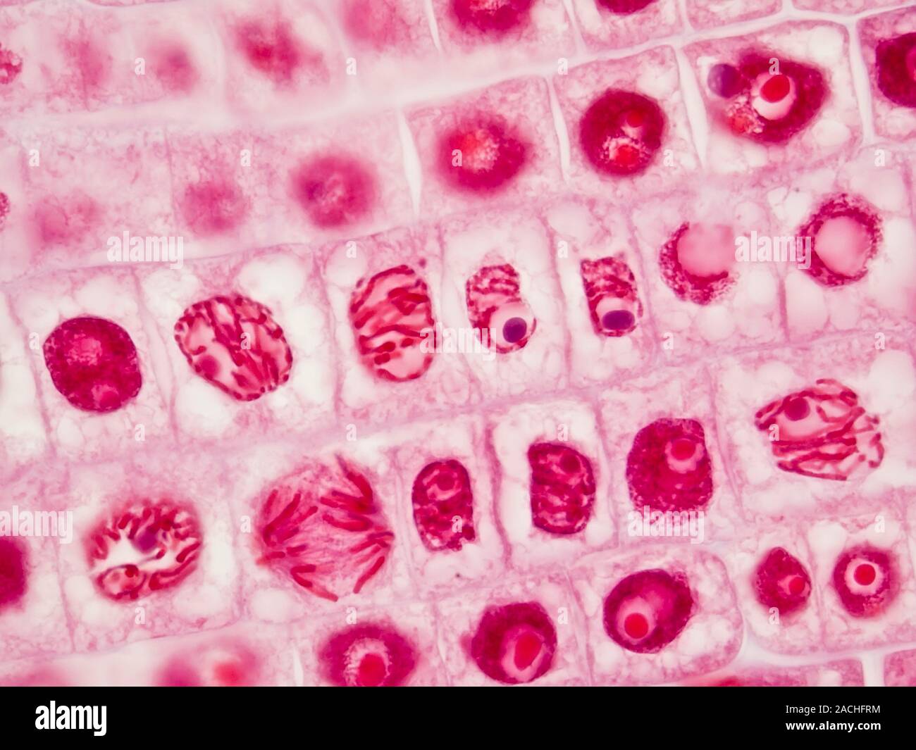 La mitose. Micrograph Light de cellules en racine de jacinthe la mitose ...