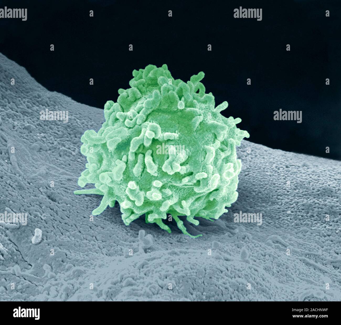 Granulocytes. Couleur de l'analyse des électrons Microphotographie (SEM ...