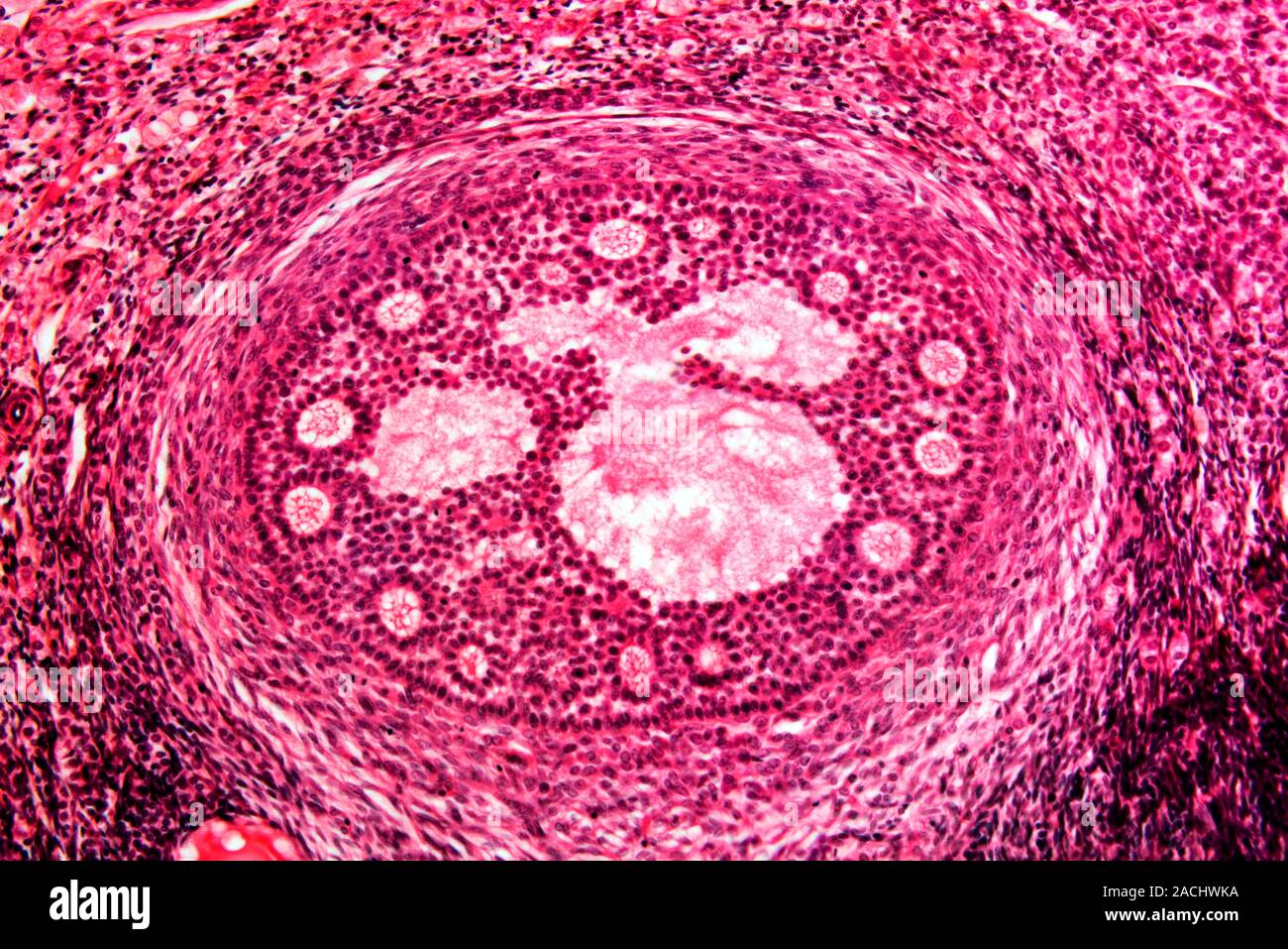 Follicule ovarien. Micrograph Light d'une section transversale à ...