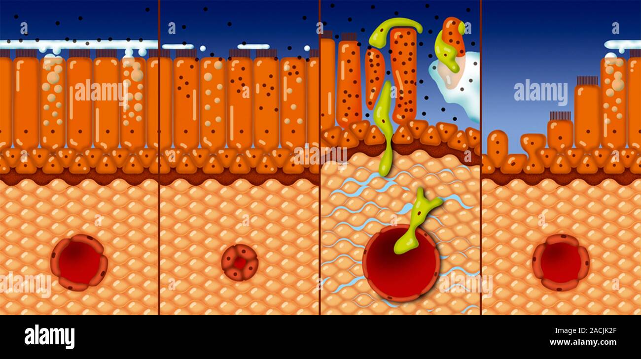 La muqueuse nasale, cross-section. Artwork d'une séquence (de gauche à ...