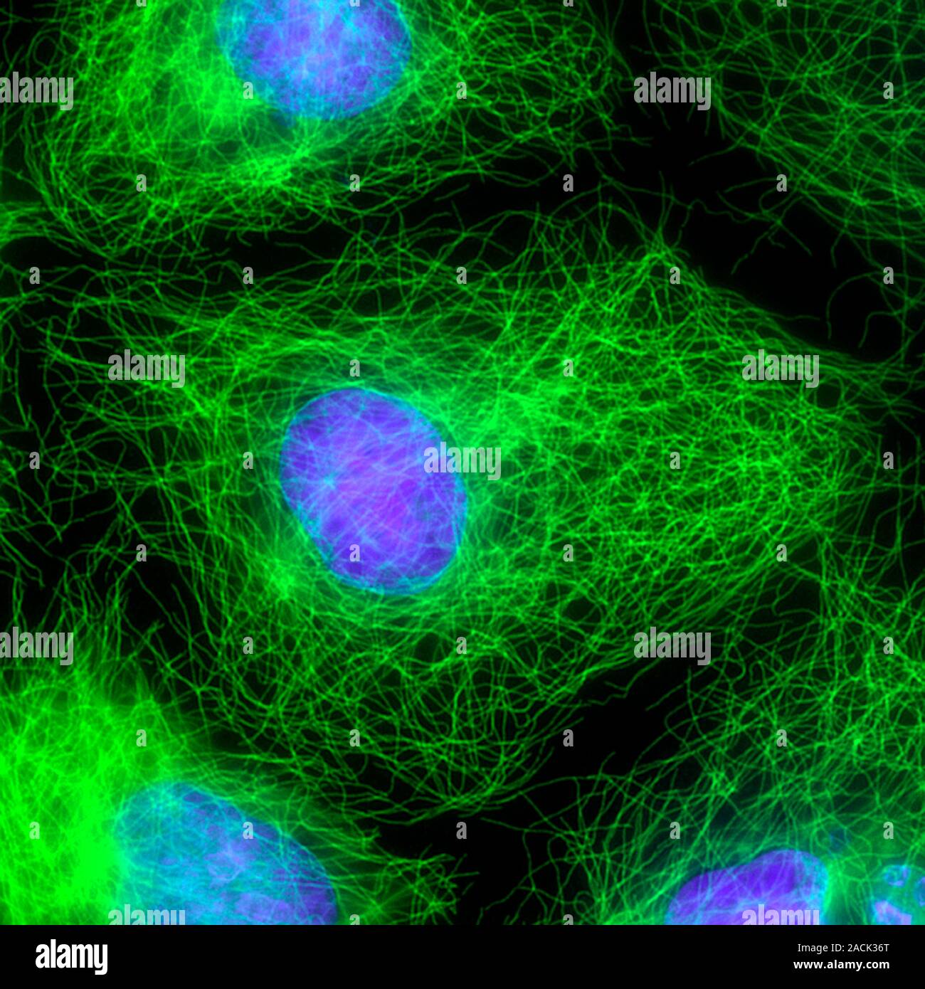 La division cellulaire. La lumière d'une micrographie par ...