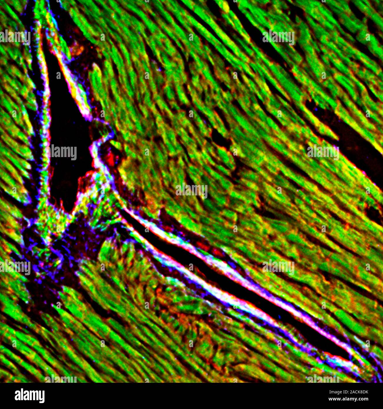 Le tissu cardiaque. La déconvolution de fluorescence d'une micrographie ...